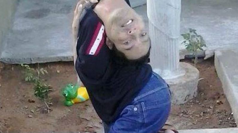 పుట్టిన 24 గంటల్లో చనిపోతాడని అనుకున్నారు.. కానీ ఇప్పుడు ప్రపంచానికి ...