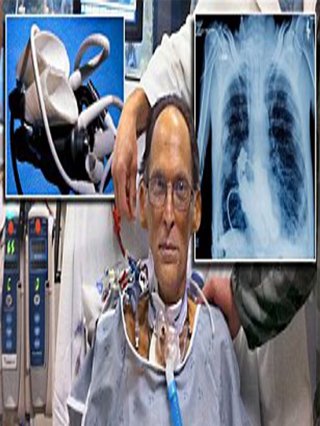 వింతల్లో వింత.. గుండె లేకుండా బతికిన ఏకైక మనిషి..! – TV9 Telugu | Craig ...